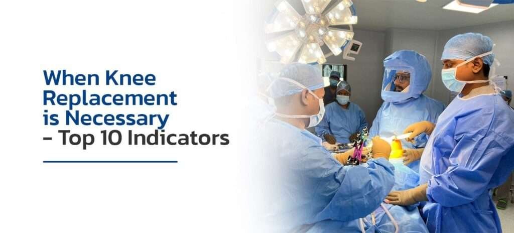 When knee replacement is necessary